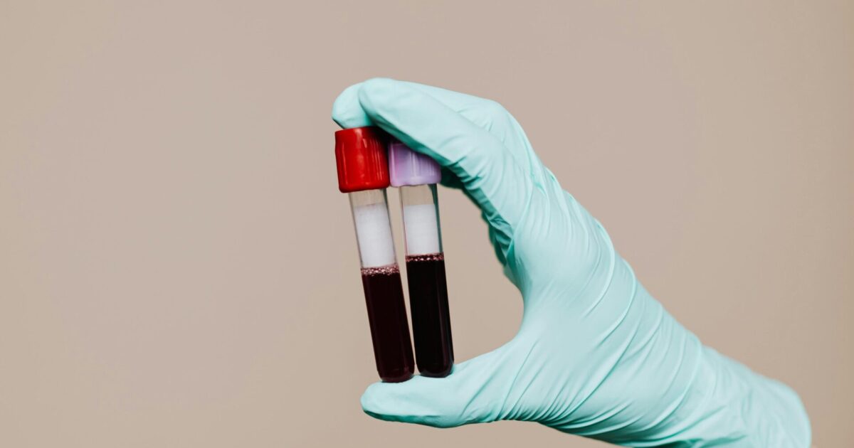 Παγκόσμια Ημέρα Αιμορροφιλίας: «Οι αιμορραγικές διαταραχές αφορούν και ...